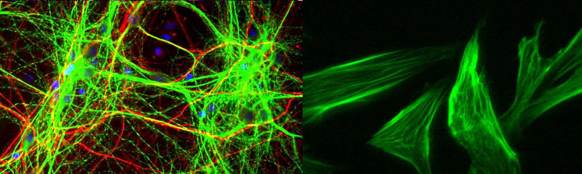 Fluorescence light sources: A comparative guide