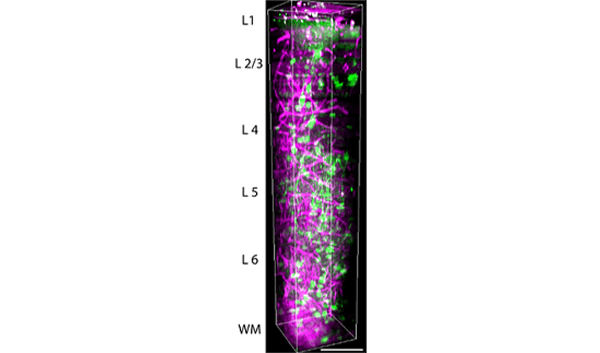 Scientifica SliceScope upright microscope