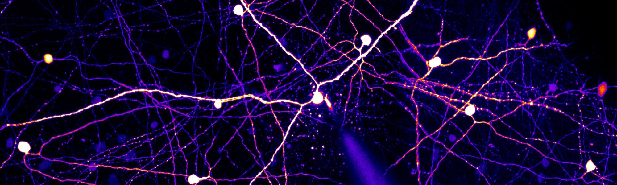 #LabHacks: Tips for improving your electrophysiology… | Scientifica
