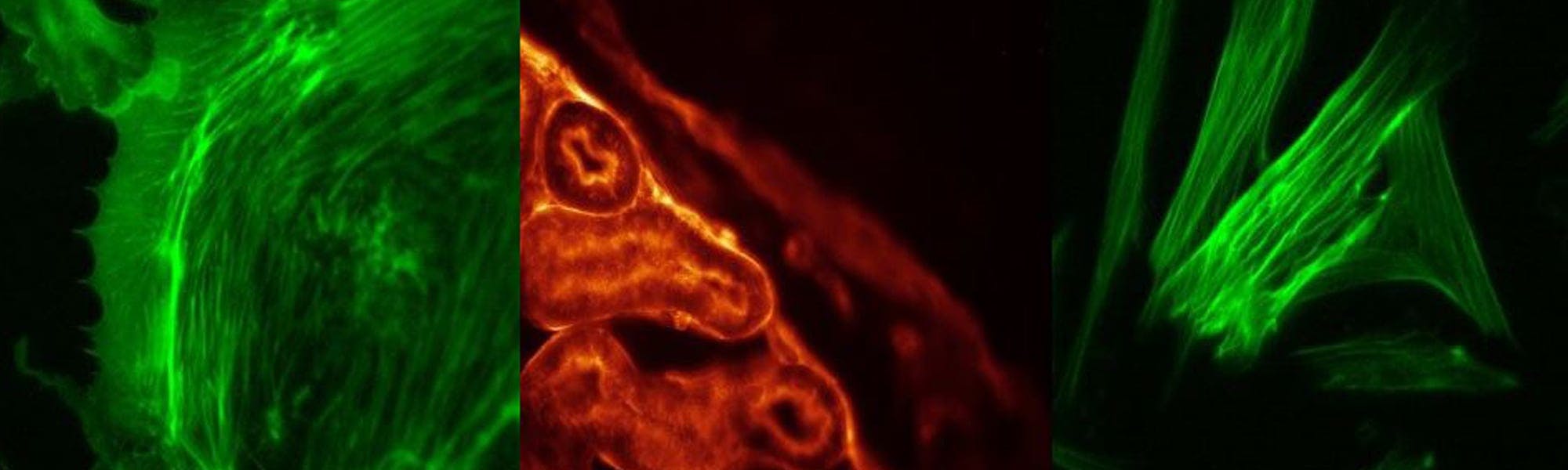 Widefield fluorescence microscopy: What you need to know | Scientifica