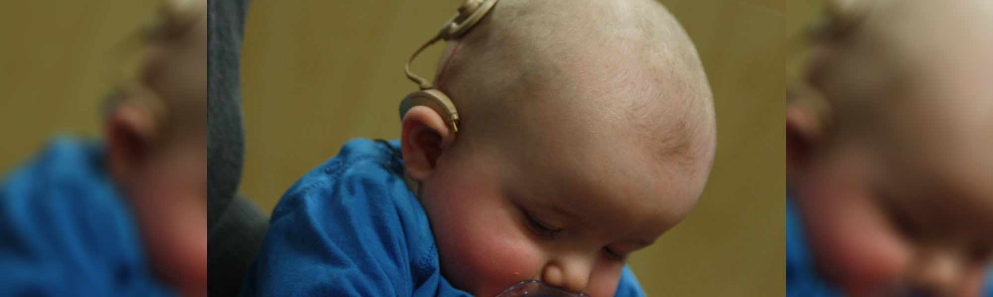 The potential of optogenetic cochlear implants