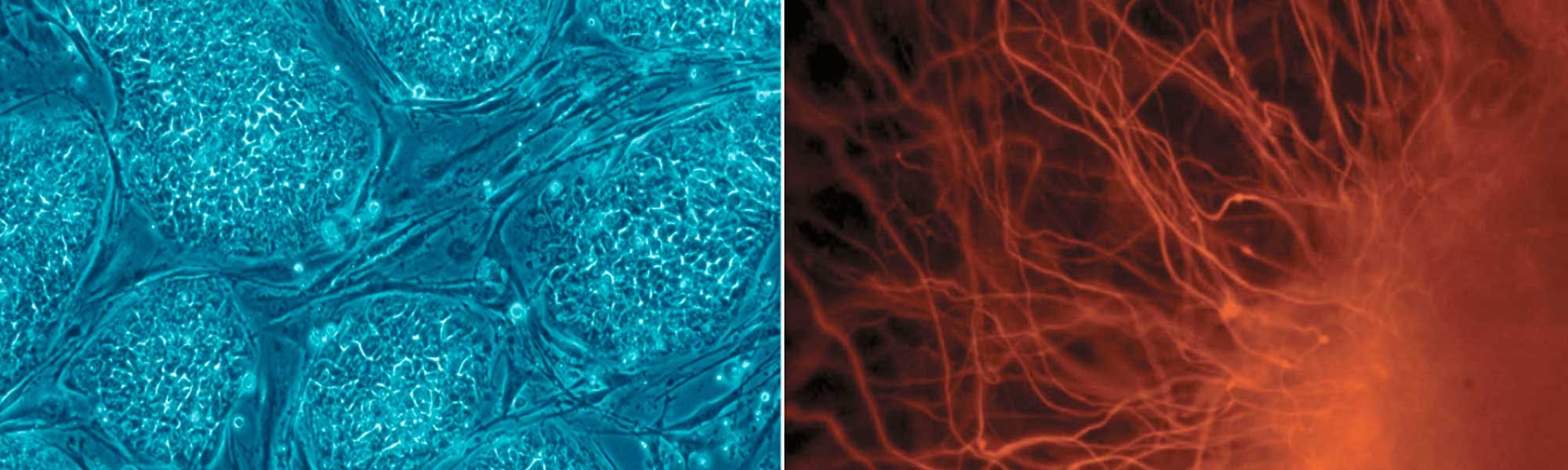 Directed differentiation: controlling stem cell fate with optogenetics