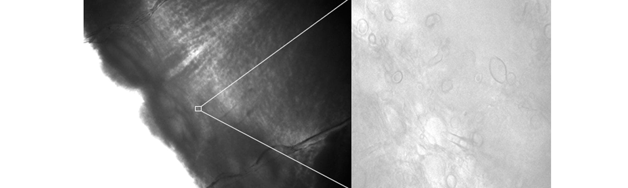 Patch clamp techniques for investigating neuronal… | Scientifica