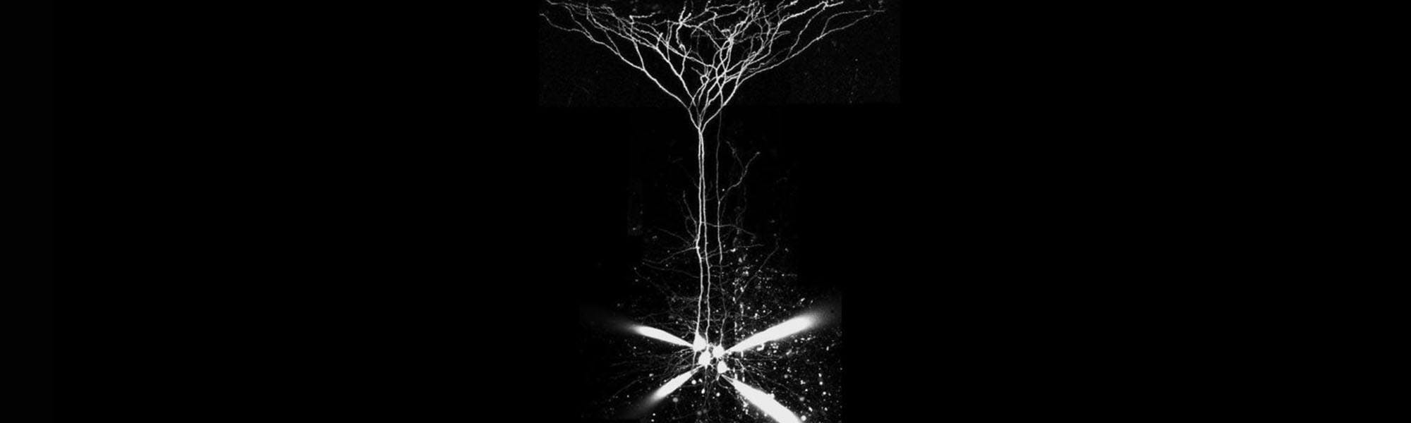 Using the PatchStar micromanipulator for a variety of… | Scientifica