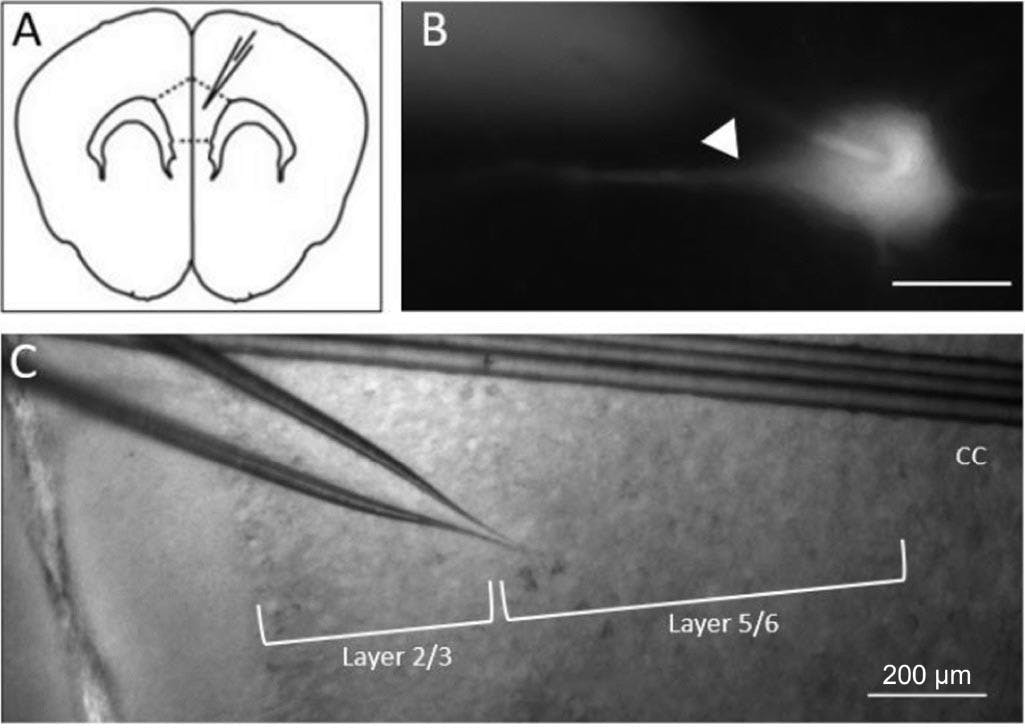 Strike True: How to accurately target your desired… | Scientifica