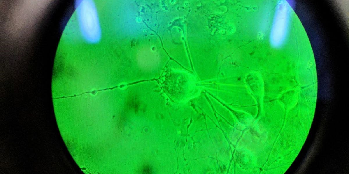 Improve the success of your slice electrophysiology experiments with ...